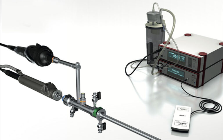 Endoscope Buying Guide: Key Factors to Consider – Uzzmed.com