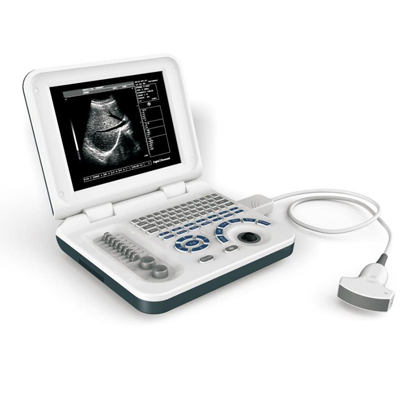 B&W Ultrasound Machine – Uzzmed.com